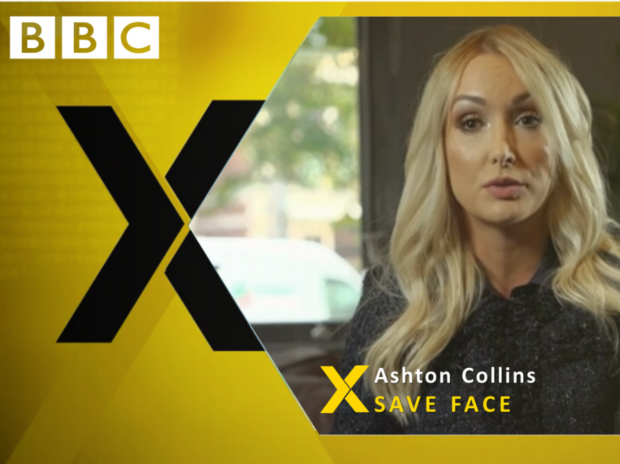 BBC X-Ray - The True Cost of Cheap Lip Fillers - Save Face