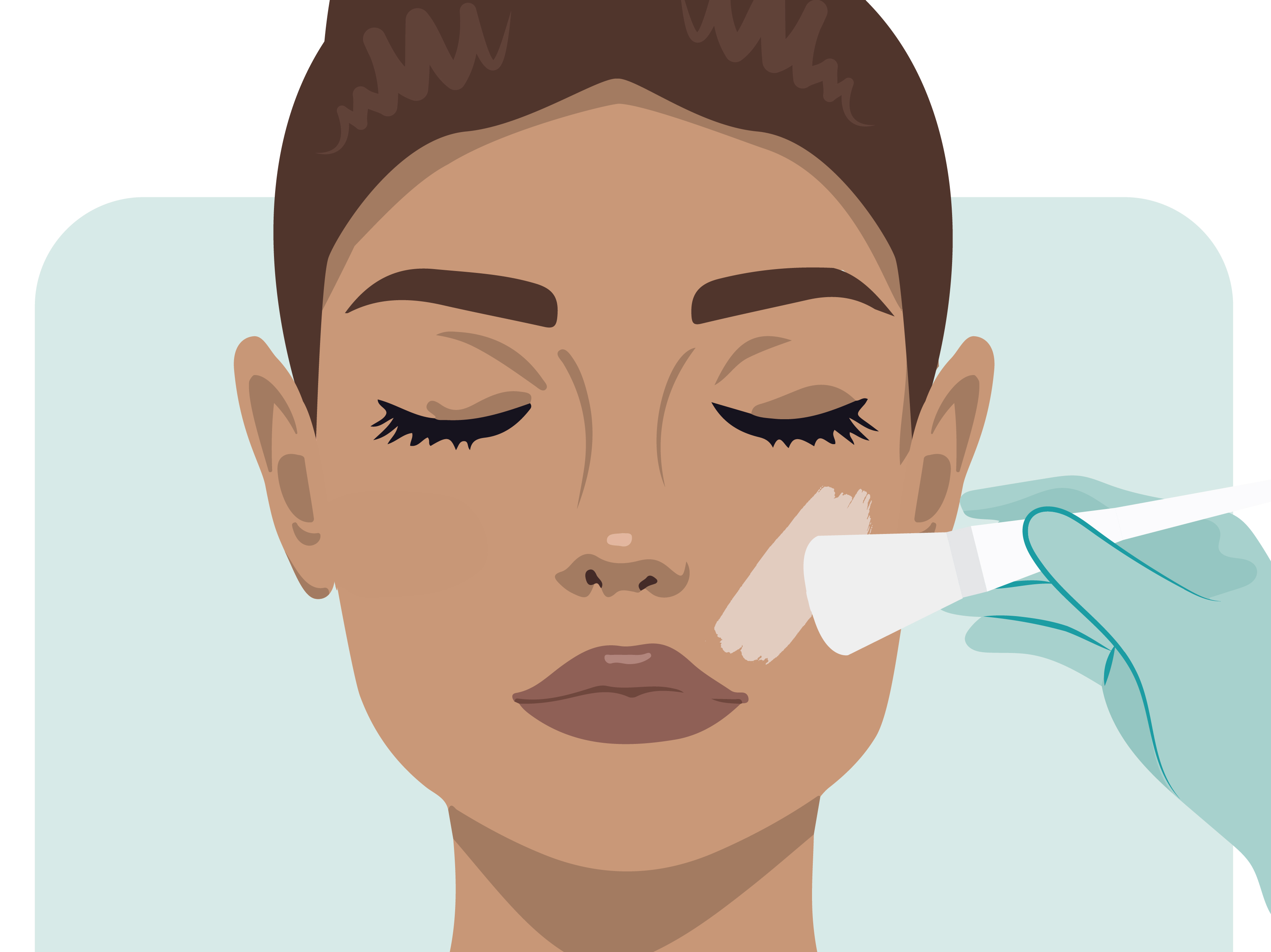 Chemical Peels - Save Face - Find a Practitioner or Clinic Today