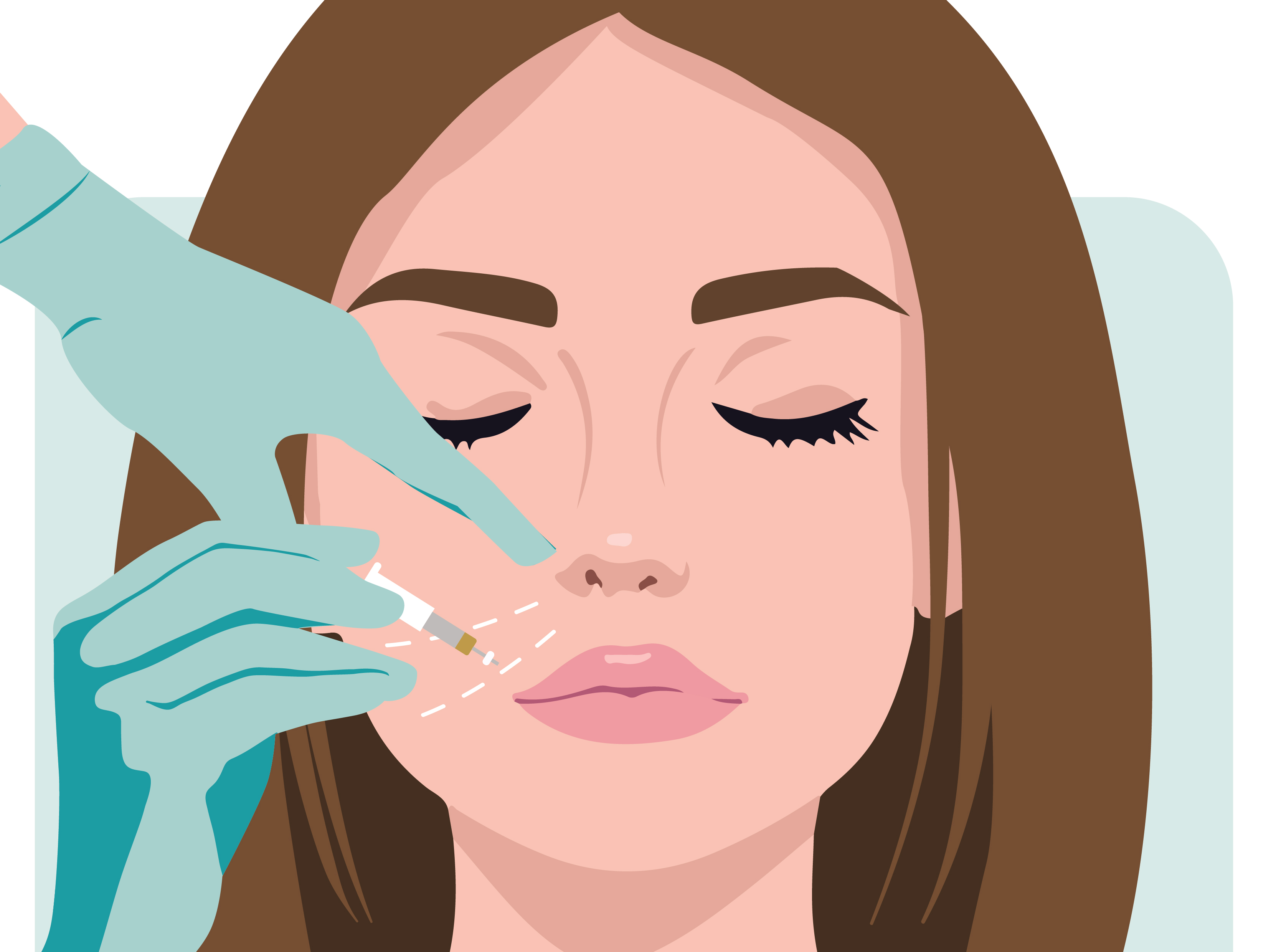 PDO Thread Lift - Save Face - Find a Practitioner or Clinic Today